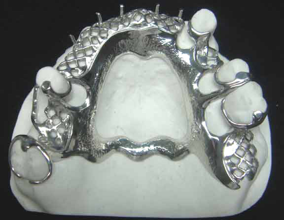 Dentures & Removables | All Points Dental